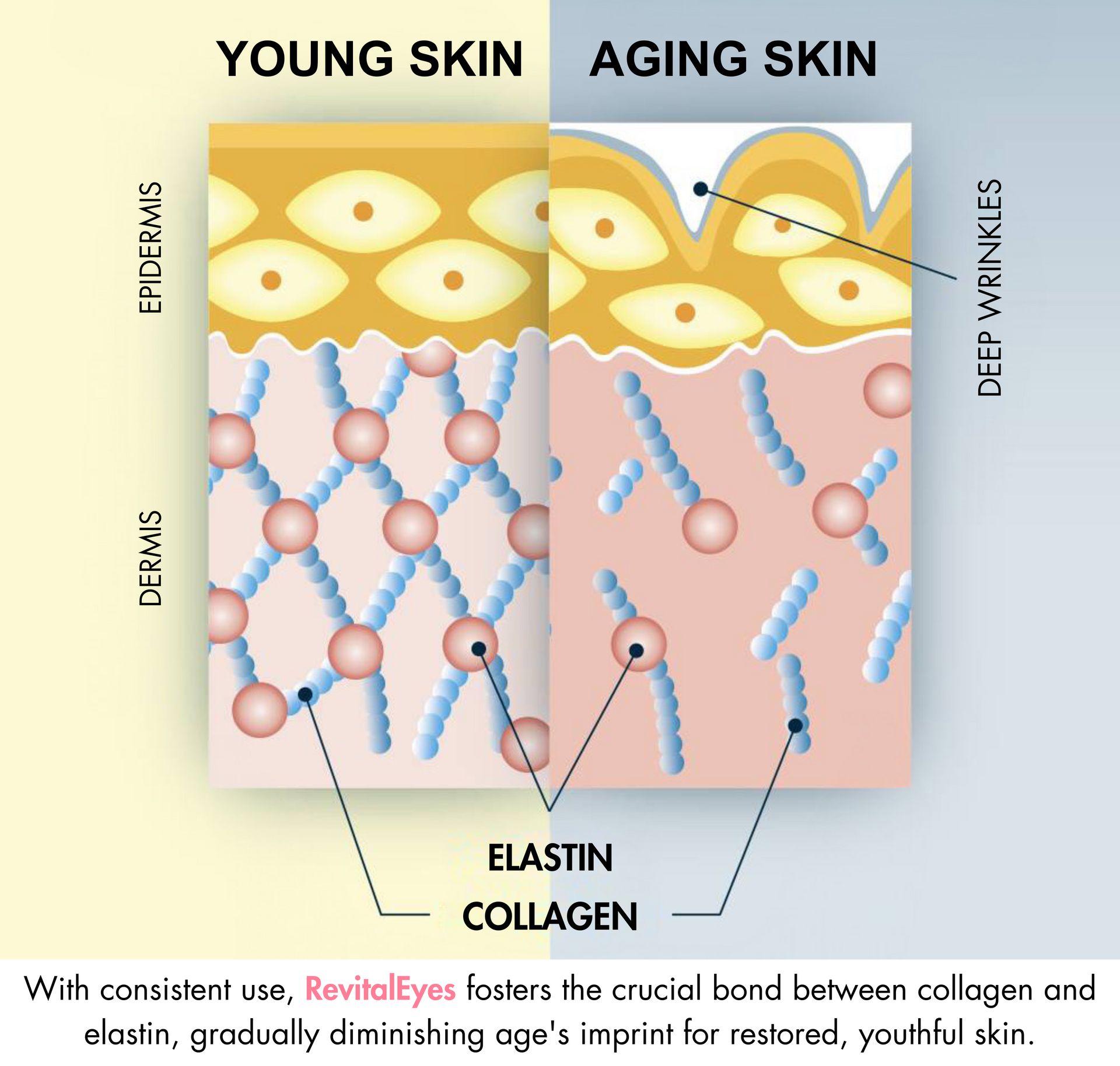 Non-Surgical Tear Trough Treatment for Brighter, Fuller Under Eyes ...