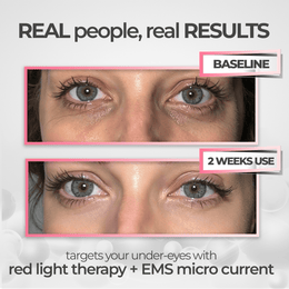RevitalEyes™ Under-Eye Red Light Therapy – Botanique Paris