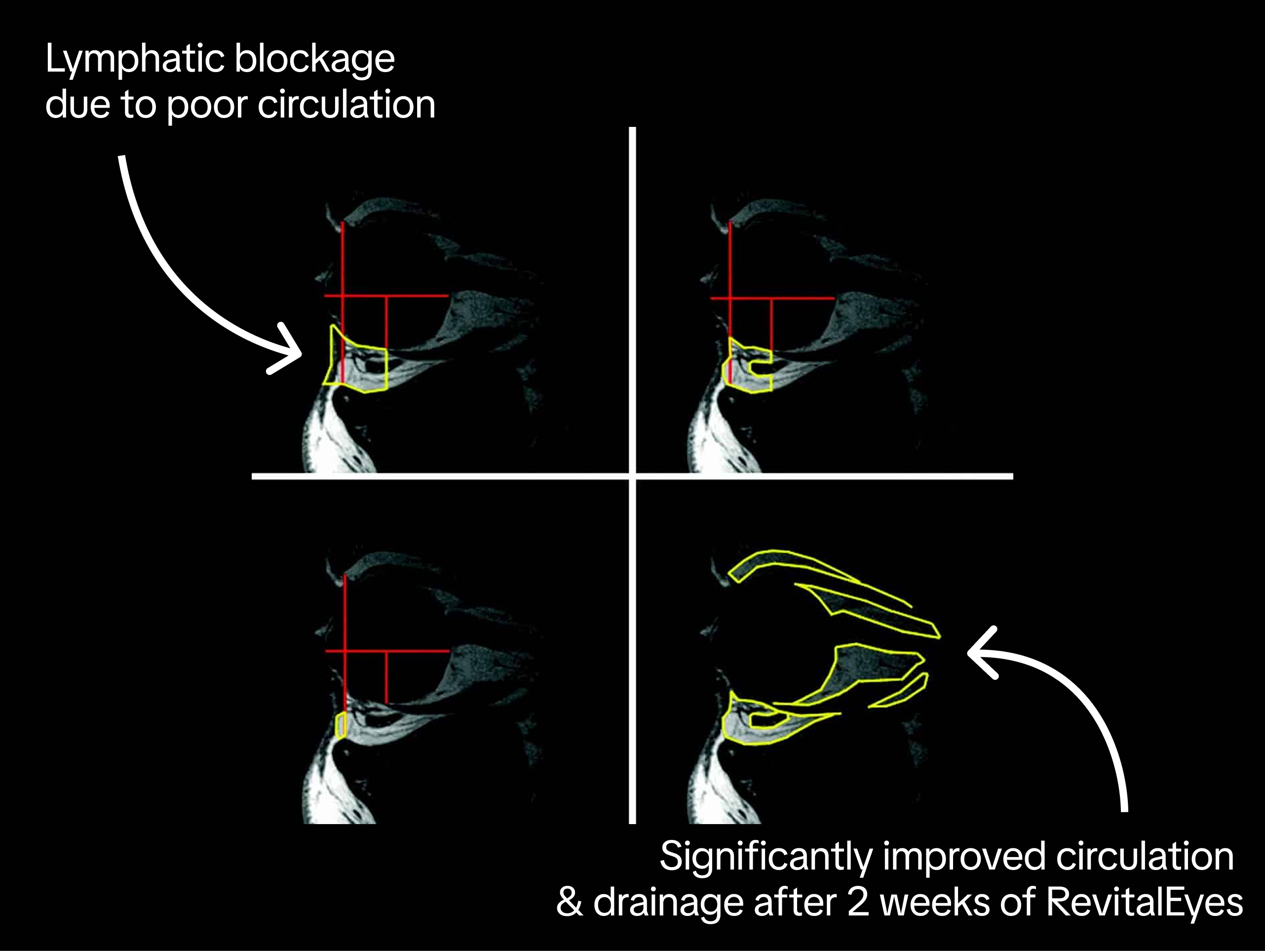 PL3.1 - PCOS – Botanique Paris